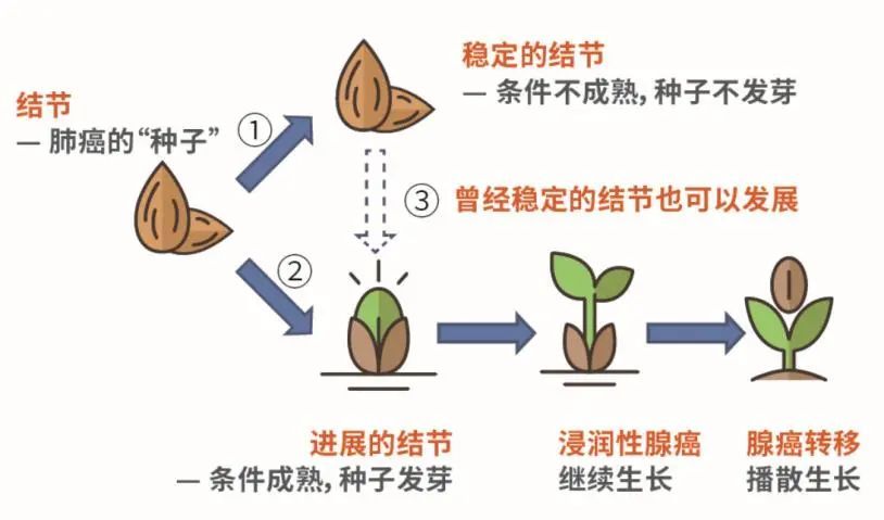 早期肺癌筛查新策略！自身抗体七项检测+LDCT，早筛效果“1+1>2”_南方+_南方plus